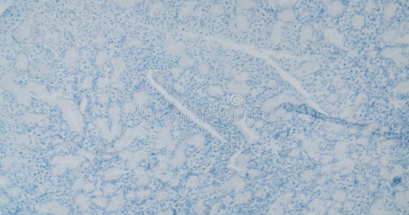 Virus Structure Under a Microscope Stock Image - Image of infection ...