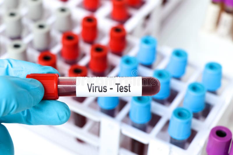 Virus Test, Blood Sample To Analyze in the Laboratory Stock Photo ...