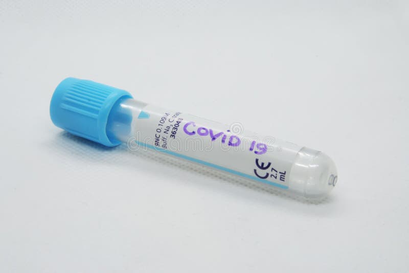 Virus Test Tube. Testing Virus. Viral Infection Test Stock Photo ...