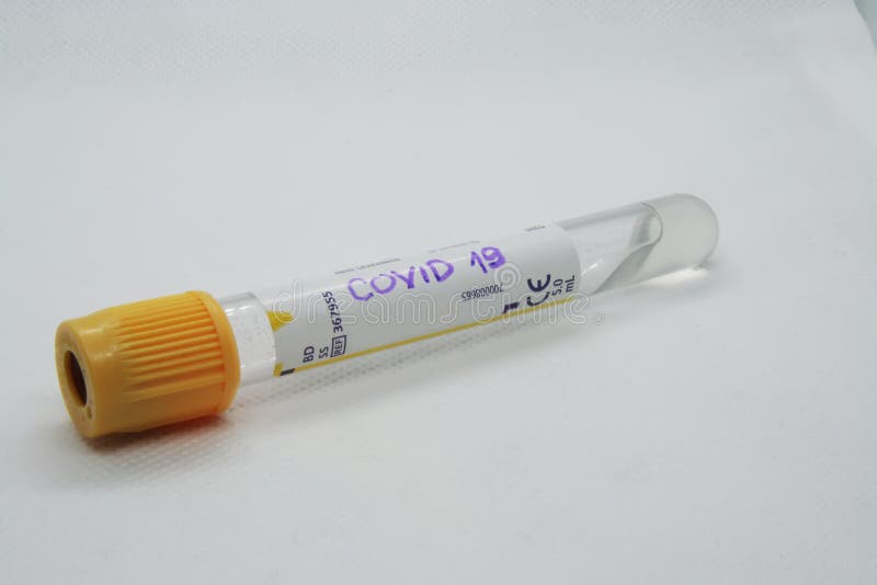 Virus Test Tube. Testing Virus. Viral Infection Test Stock Image ...