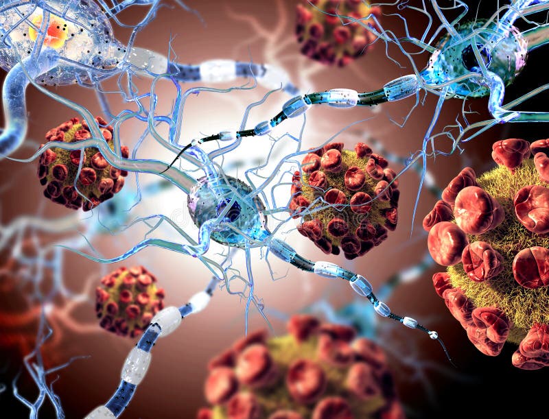 Viruses Attacking Nerve Cells Stock Photo - Image of diseases, epilepsy ...