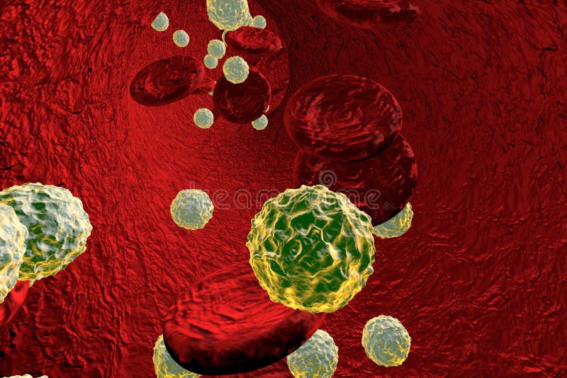 Viruses in Blood, Systemic Infection Stock Illustration - Illustration ...