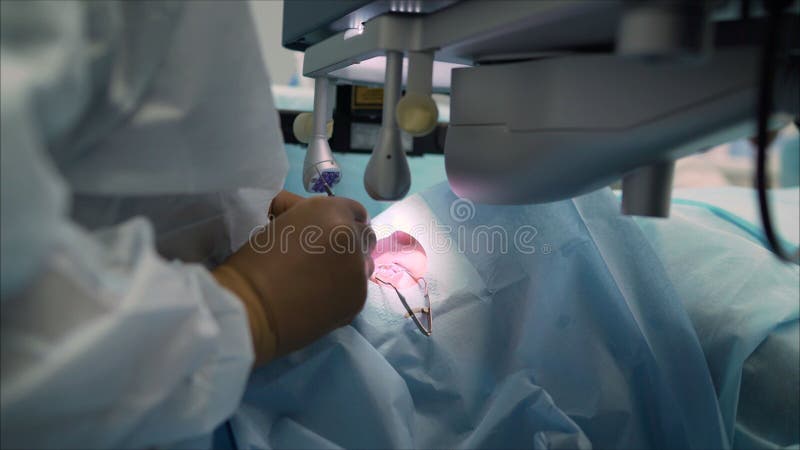 Eye Surgeon Operating Woman with Laser Vision Correction Machine in the ...