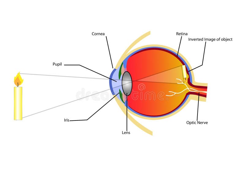 Disordine Di Visione Delle Cataratte Ed Anatomia Normale Di Visione ...