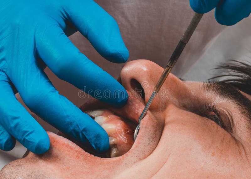 Visiting the Dentist, the Dentist Evaluates the Oral Cavity and ...