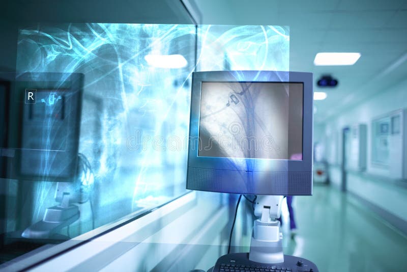 Visual Projection of an X-ray Image in the Hospital Stock Image - Image ...