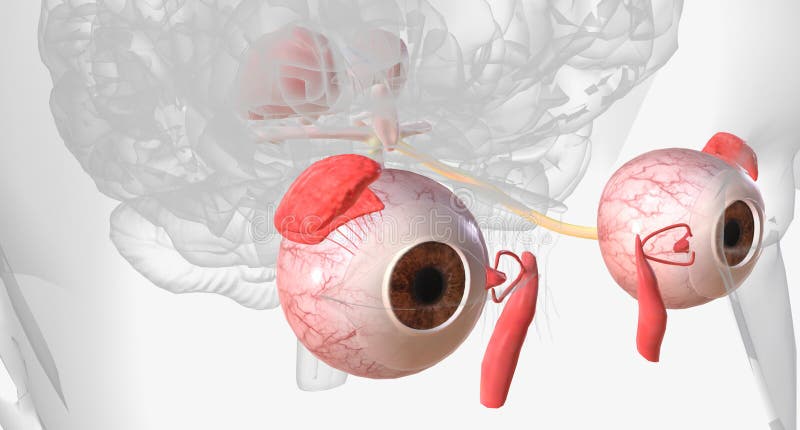 The Visual System Contains the Eyes, Optic Nerves, Optic Tracts, and ...