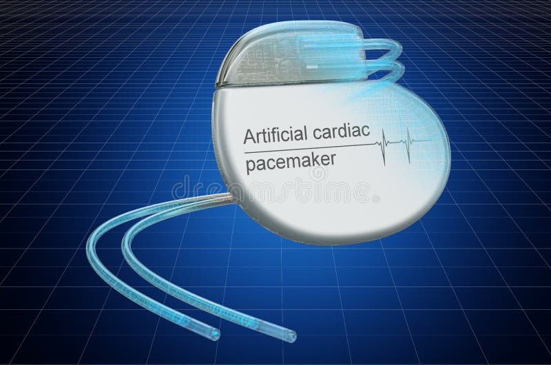 Pacemaker Model Stock Illustrations – 66 Pacemaker Model Stock ...