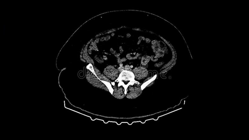 Visualization and Analysis of MRI Scans by a Radiologist on a Computer ...