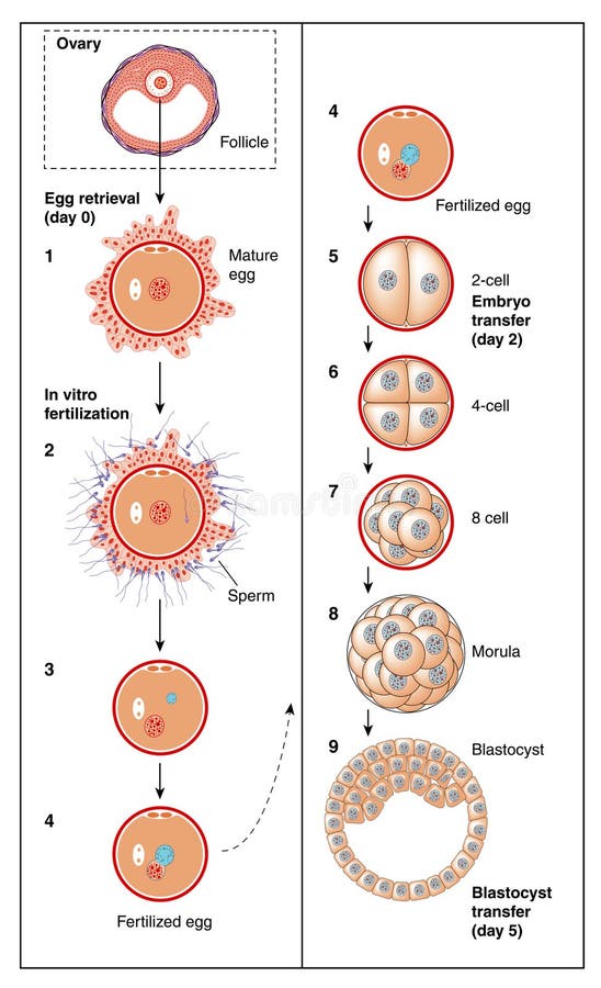 In Vitro Fertilization Diagram
