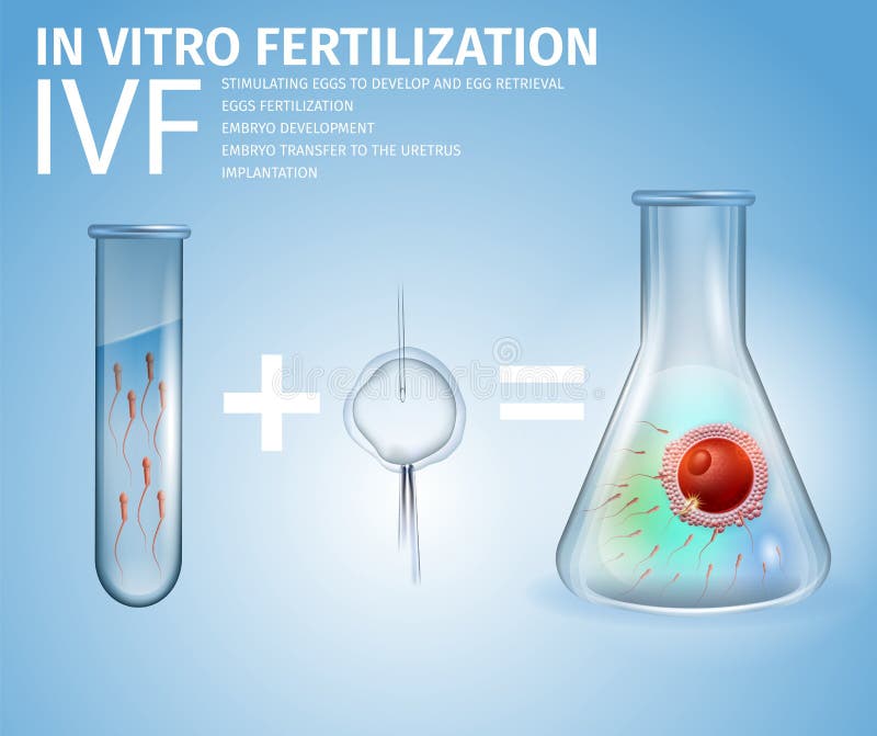 Ivf Banner Stock Illustrations – 261 Ivf Banner Stock Illustrations ...