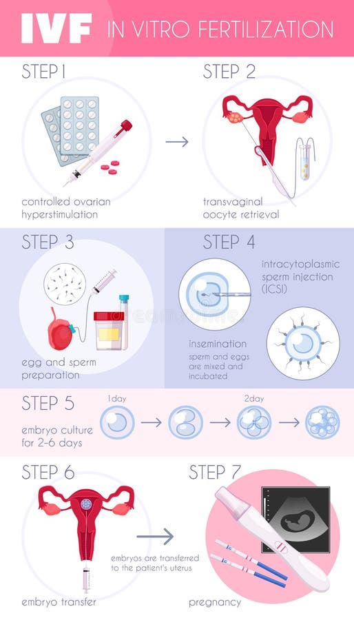 Ivf Infographics Stock Illustrations – 59 Ivf Infographics Stock ...