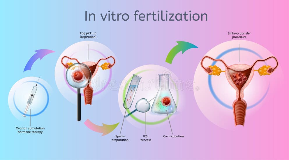 Fertilization Process Stock Illustrations – 885 Fertilization Process ...
