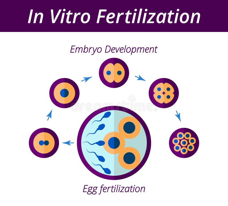 In Vitro Fertilization Scheme Stock Illustration - Illustration of ...