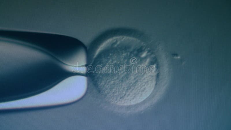 In Vitro Fertilization Under a Microscope. Stock Video - Video of ...