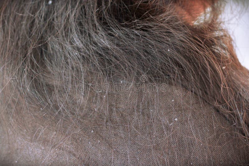 Vrouwen Die Hoofdroos Hebben Stock Afbeelding - Image of sociaal, roes ...