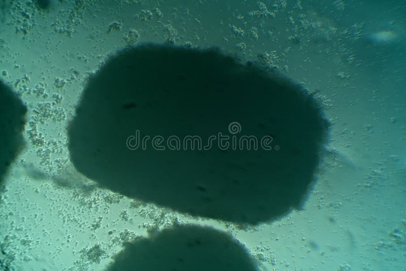 Levure au microscope image stock. Image du médical, mycètes - 111147649