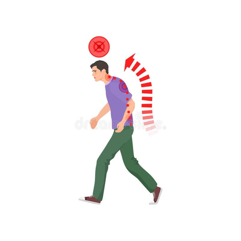 Walking Man in Wrong Spine Posture Stock Vector - Illustration of ... Walking Man in Wrong Spine Posture Stock Vector - Illustration of ...