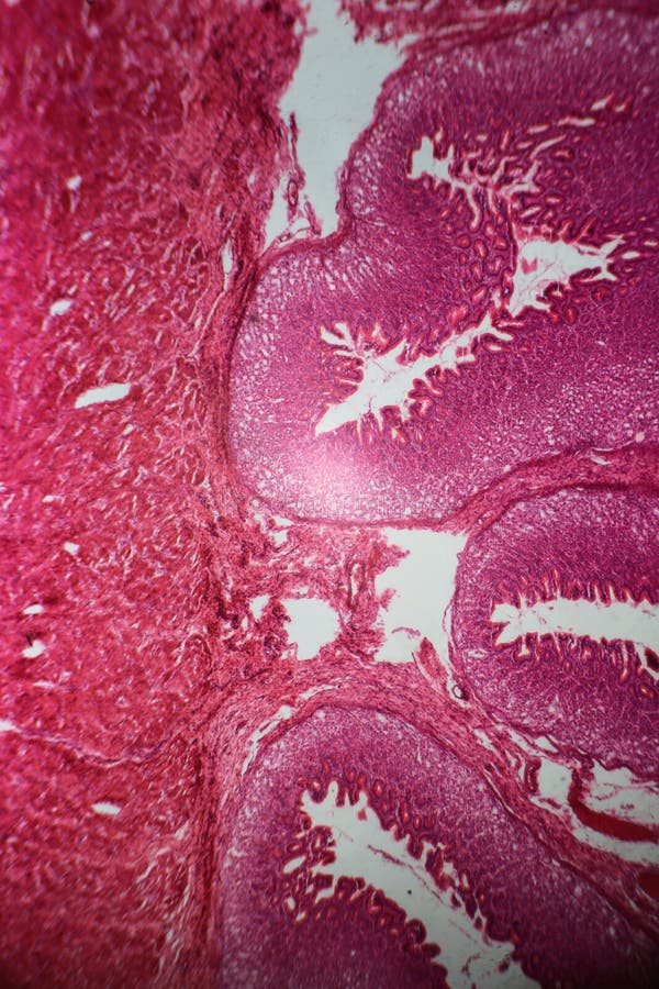 Tissue Of Stomach Under The Microscope For Education. Stock Photo ...
