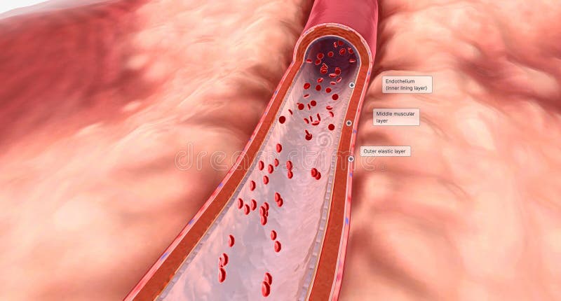 The Walls of Arteries Contain Three Layers. Endothelium, a Middle ...