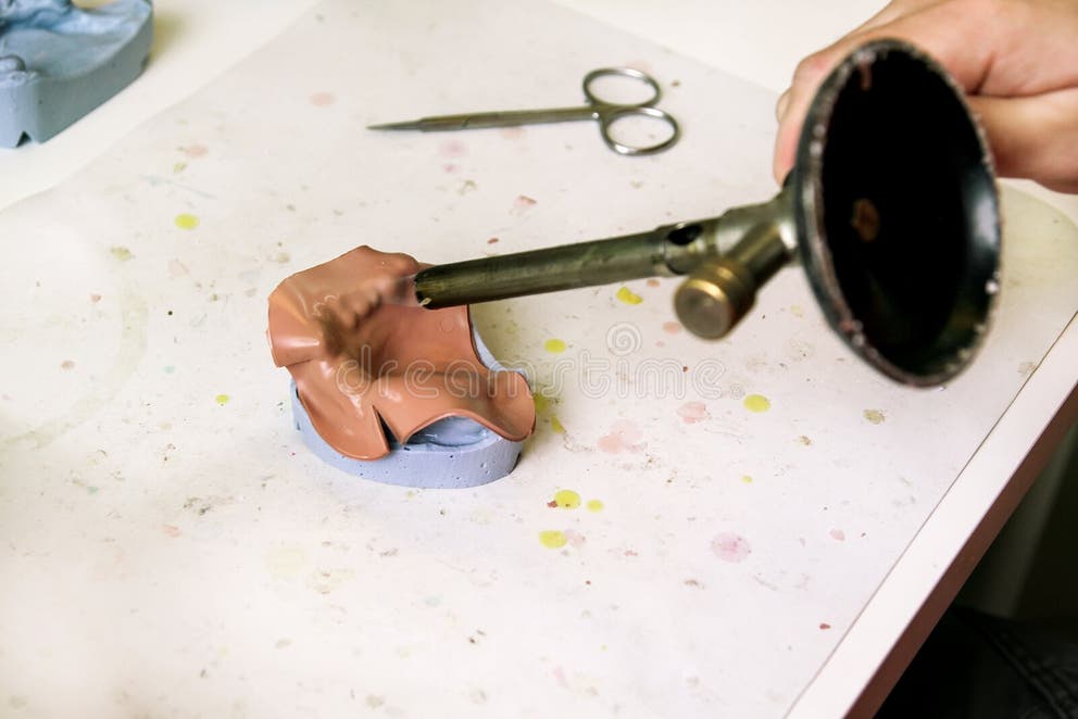 Warming of Shellac Base Plates Over the Plaster Model Stock Image ...