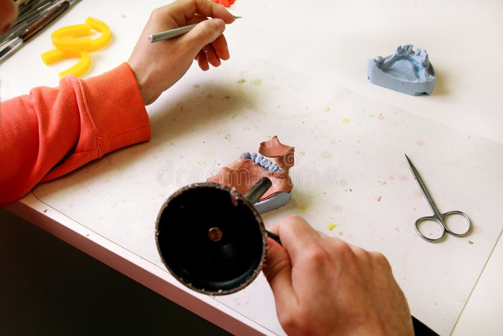Warming of Shellac Base Plates Over the Plaster Model Stock Photo ...