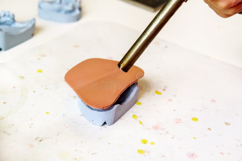 Warming of Shellac Base Plates Over the Plaster Model Stock Image ...