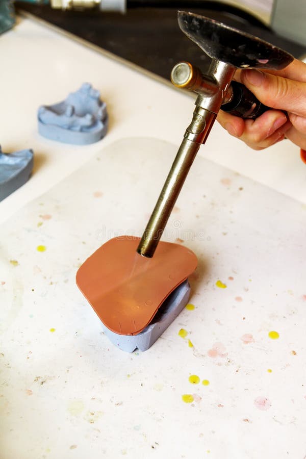 Warming of Shellac Base Plates Over the Plaster Model Stock Image ...