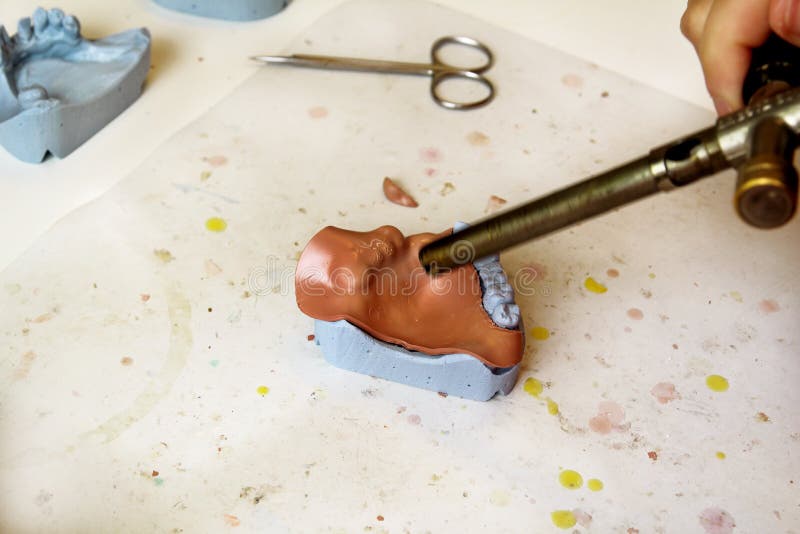 Warming of Shellac Base Plates Over the Plaster Model Stock Photo ...