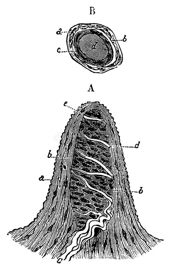 Anatomy of Wart stock vector. Illustration of human, disease - 37494336