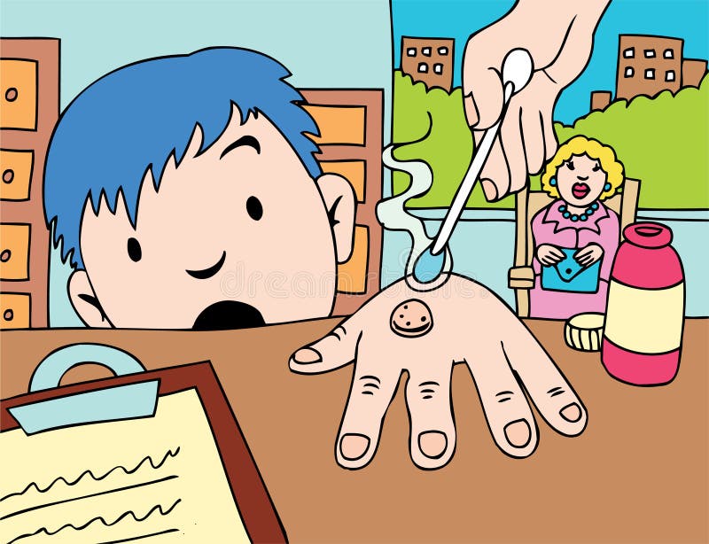 Wart Removal stock vector. Illustration of wart, treat - 9488711