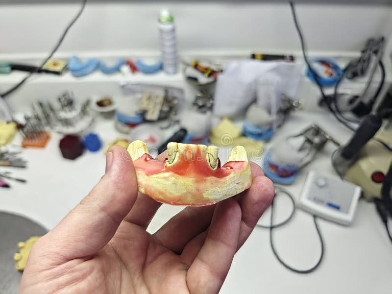 Wax dentures model stock photo. Image of professional - 278671148