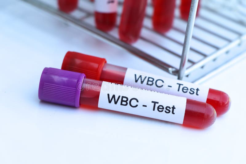 WBC Test To Look for Abnormalities from Blood Stock Image - Image of ...