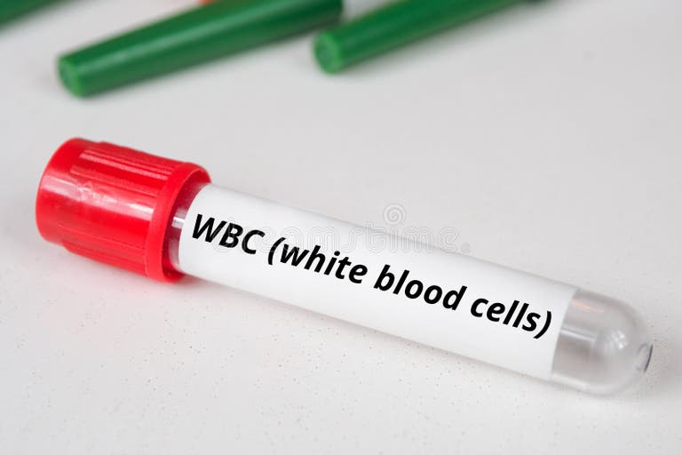 WBC (white Blood Cells) Name of Blood Test Stock Photo - Image of blood ...