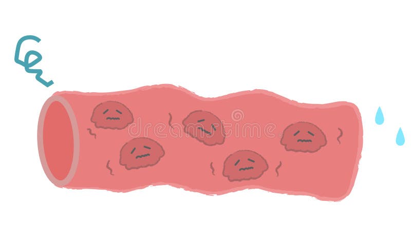 Blood Vessel Cartoon Stock Illustrations – 1,338 Blood Vessel Cartoon ...