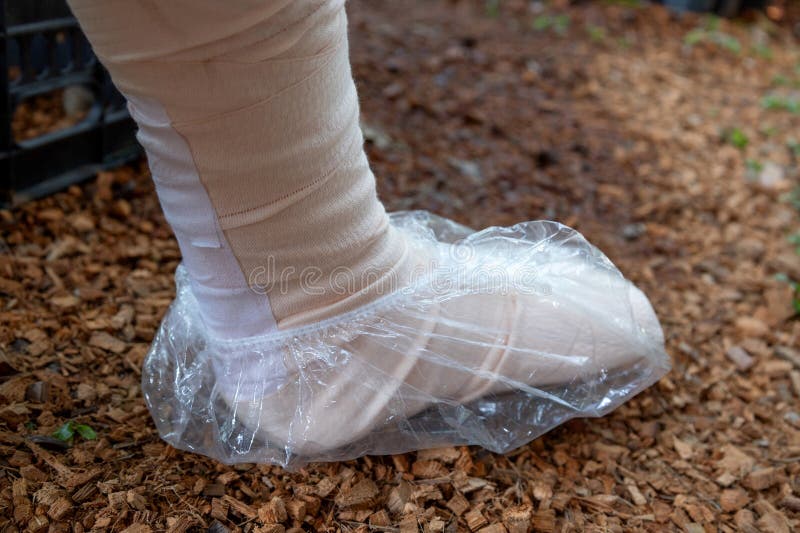 Wearing a Plastic Bag Over the Cast while Walking Stock Photo - Image ...
