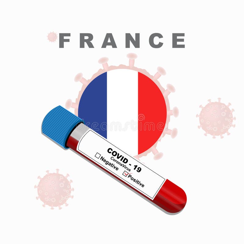 France Test Tube with Blood Sample for COVID-19, Coronavirus Test ...