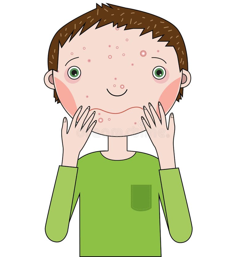 Young Boy Acne Treatment Stock Illustrations – 76 Young Boy Acne ...