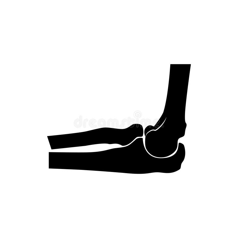 Elbow Joint Bones Icon, Vector Illustration Stock Vector - Illustration ...