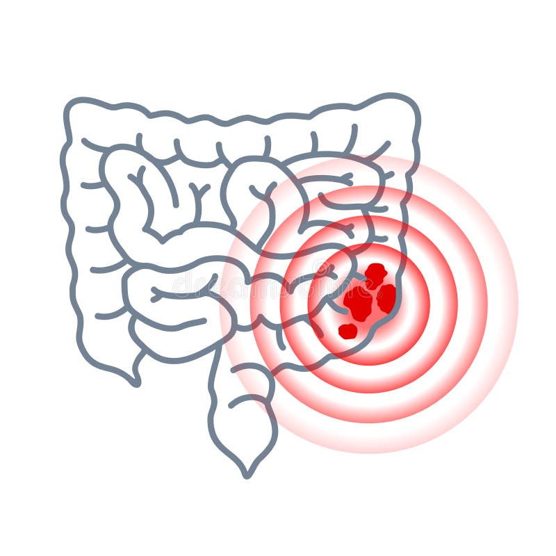 Colon Cancer Icon - Intestine and Pain Circles Stock Vector ...