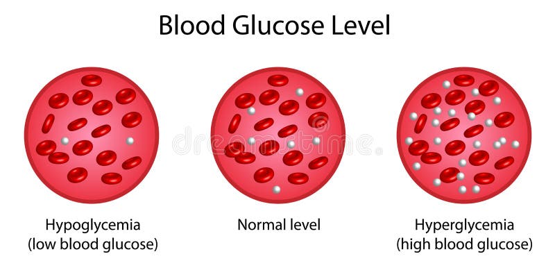 Blood Glucose Levels. Normal Level, Hyperglycemia , Hypoglycemia, Sugar ...