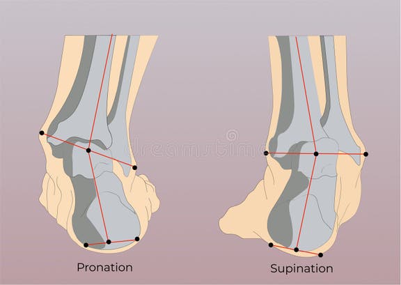 Foot Supination and Pronation Vector Illustration. Stock Vector ...