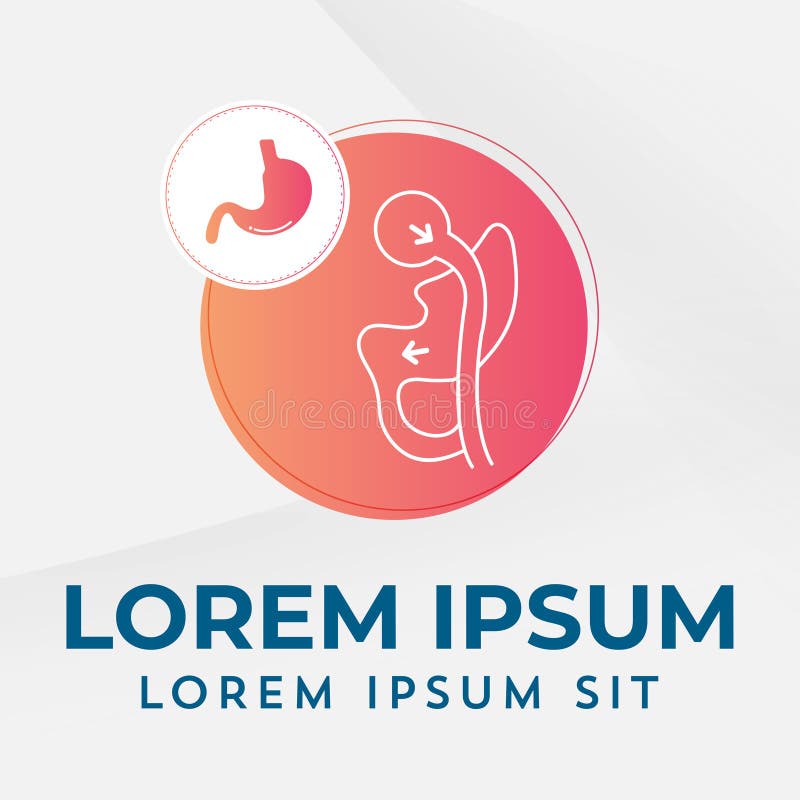 Gastric Bypass Logo Roux-en-Y (RNY) Weight Loss Surgery Logo Vector ...