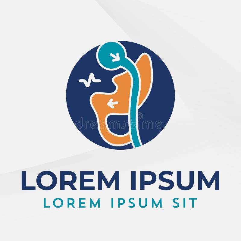 Gastric Bypass Logo Roux-en-Y (RNY) Weight Loss Surgery Logo Vector ...