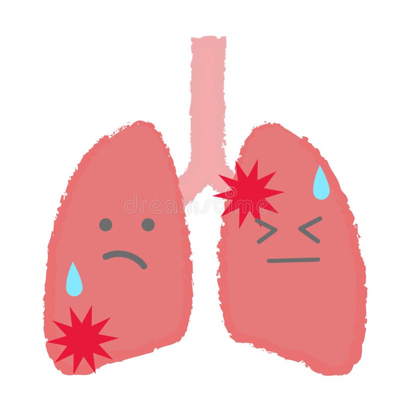 Illustration of a Character with Damaged Lungs Stock Vector ...