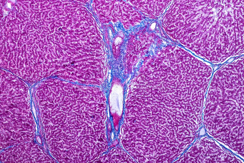 Weefsel Van Lever Onder De Microscoop Voor Onderwijs Stock Foto - Image ...