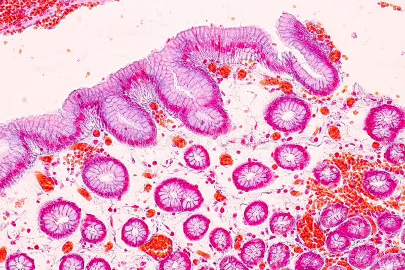 Weefsel Van De Maag, Menselijk Kleine Darm, Menselijke Alvleesklier En ...