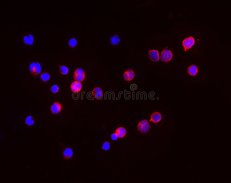 Weiße Blutzellen stockfoto. Bild von klinik, medizin - 23325066