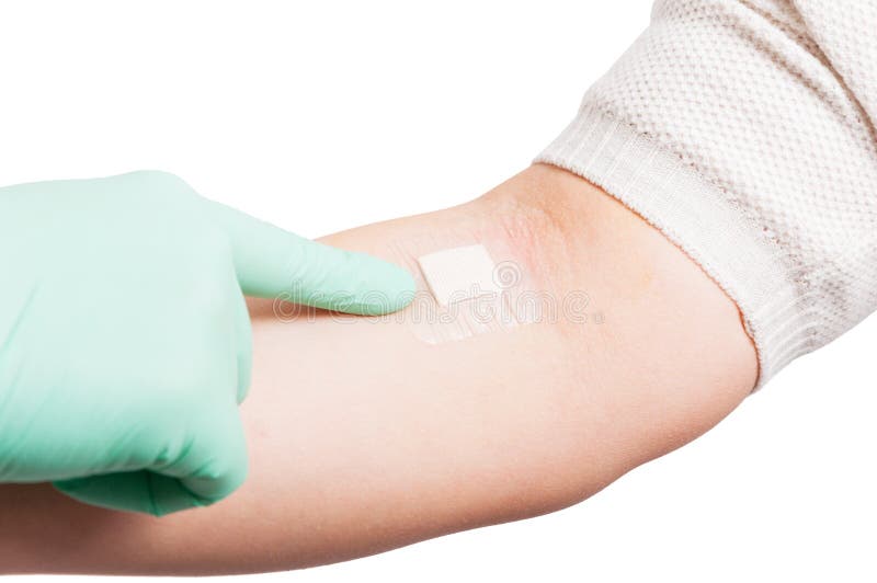 Weibliche Hand Mit Flecken Auf Ader Stockfoto - Bild von dosis, gesund ...