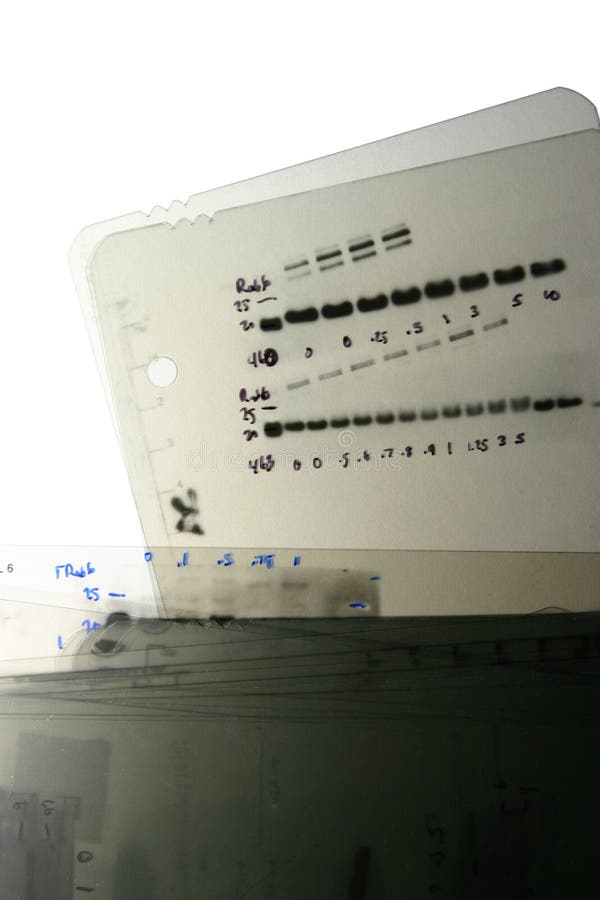 Anatomy of an antibody stock vector. Illustration of antibody - 12436223